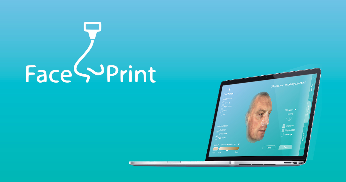 FacePrint - Market-ready 3D printing service for prosthetics